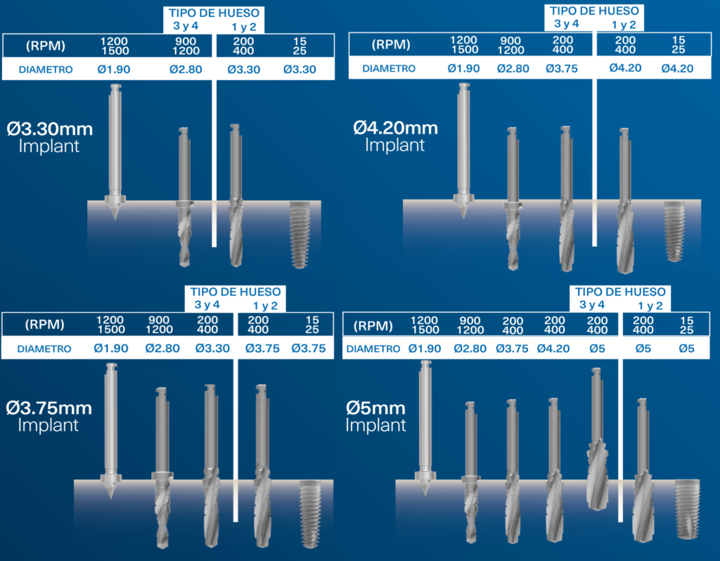 Implante dental XD | MIS Implants